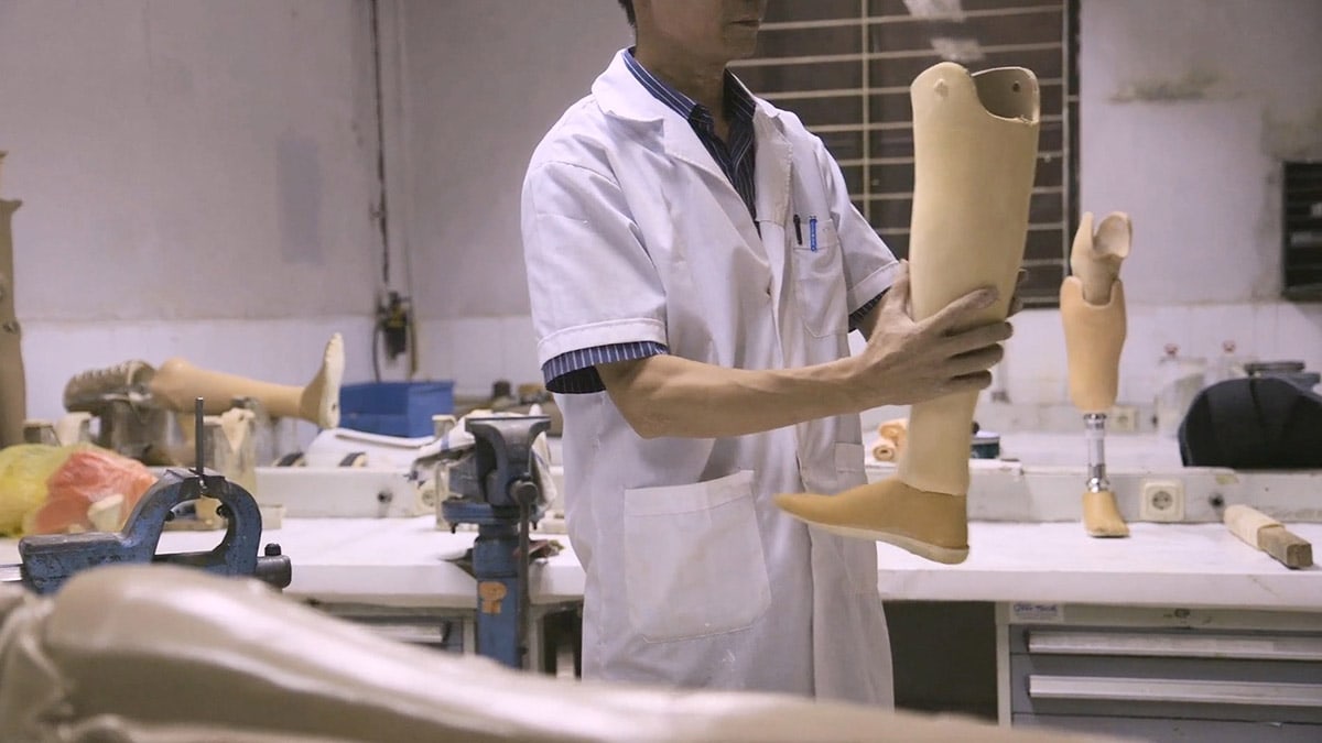 Recasting the artificial limb | NGV